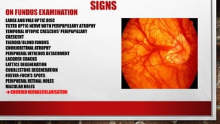 Peripapillary Crescent
