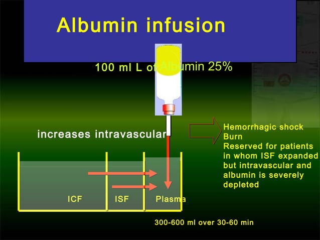 Update on fluid therapy in dhf | PPT