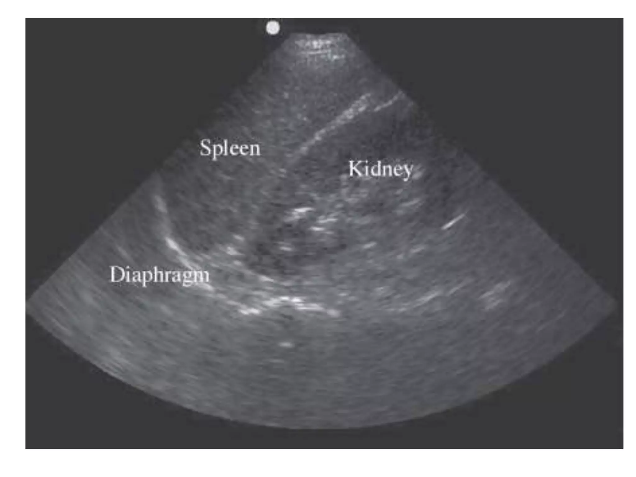 FAST (Focused Assessment Sonography for Trauma) | PPTX