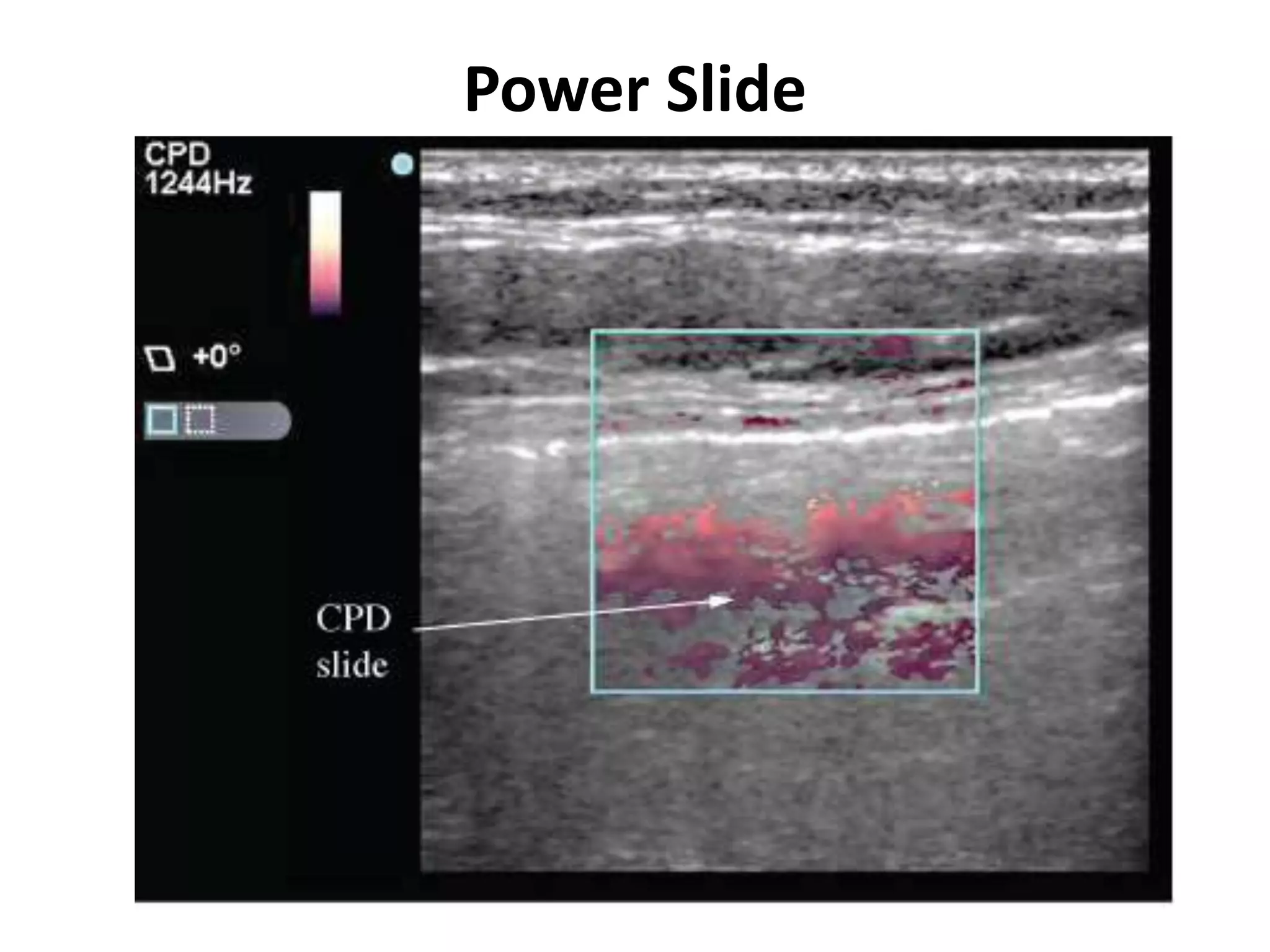 FAST (Focused Assessment Sonography for Trauma) | PPTX