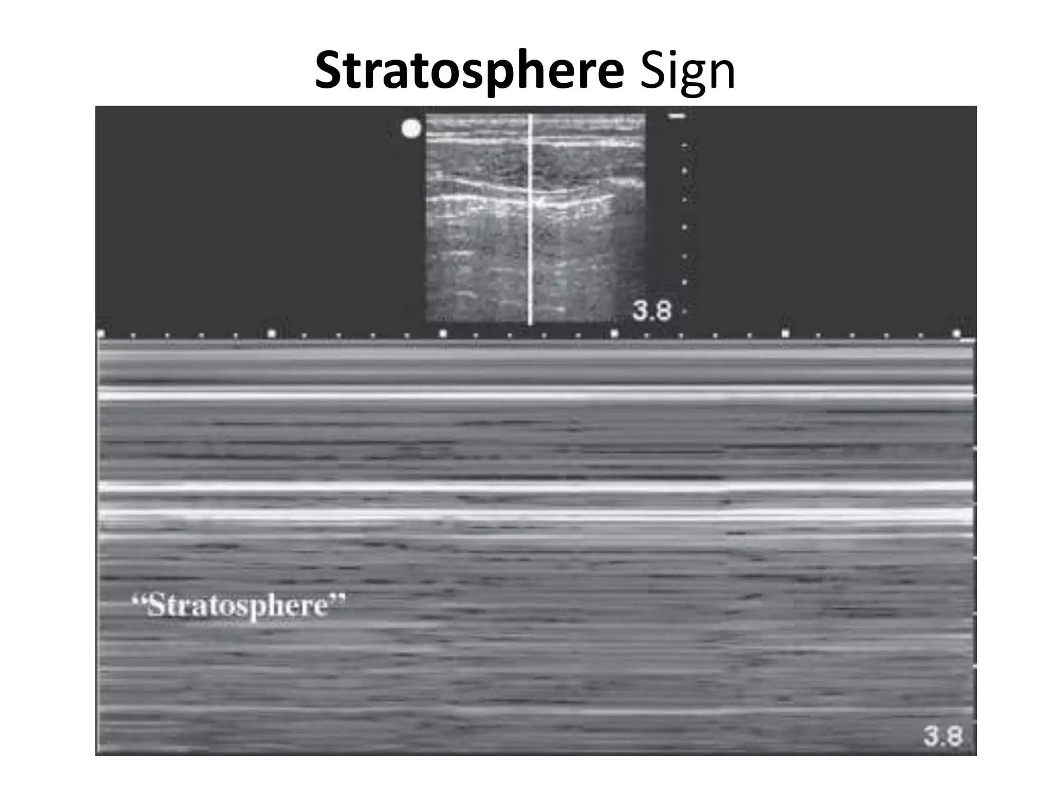 FAST (Focused Assessment Sonography for Trauma) | PPTX