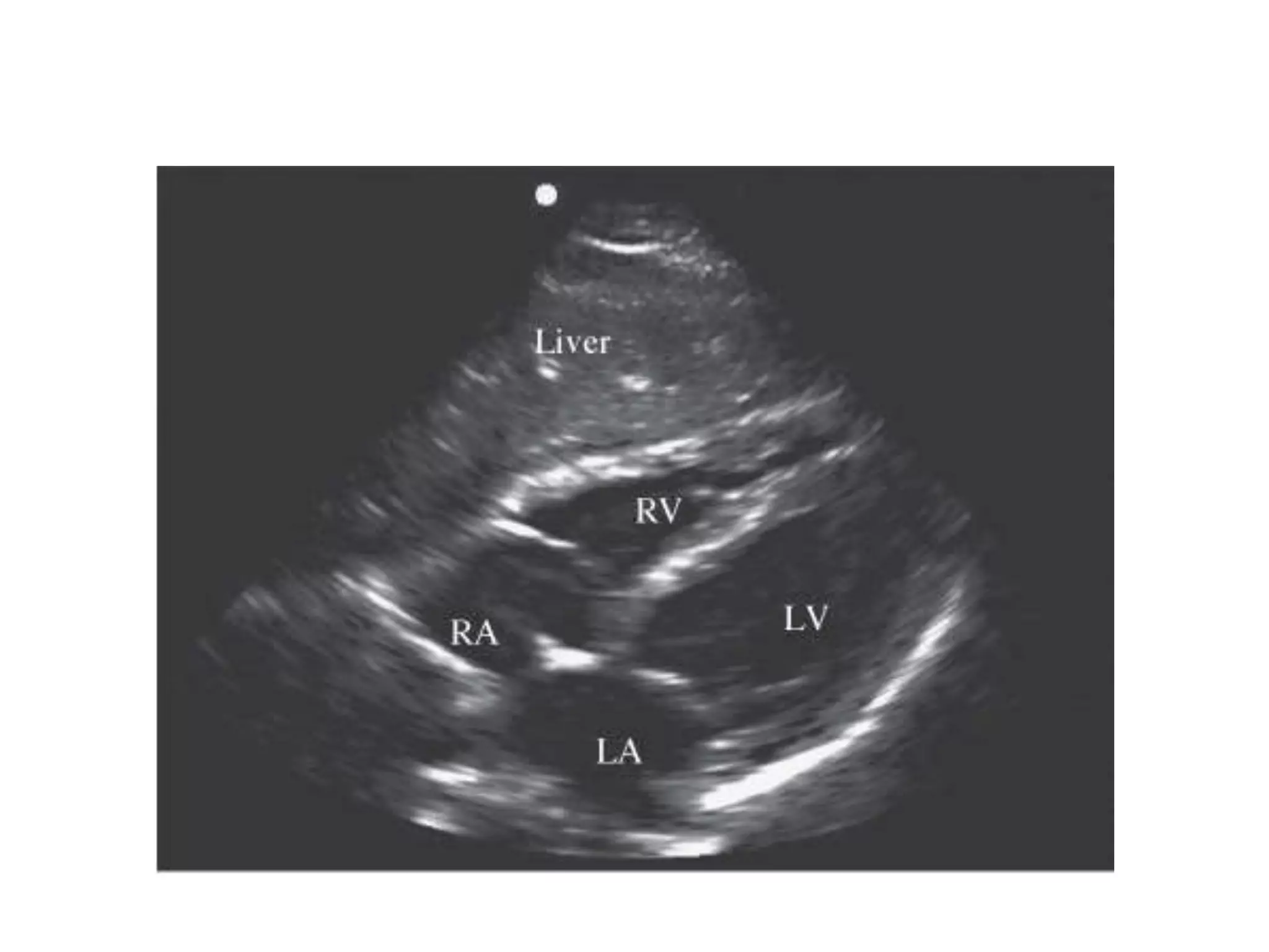 FAST (Focused Assessment Sonography for Trauma) | PPTX
