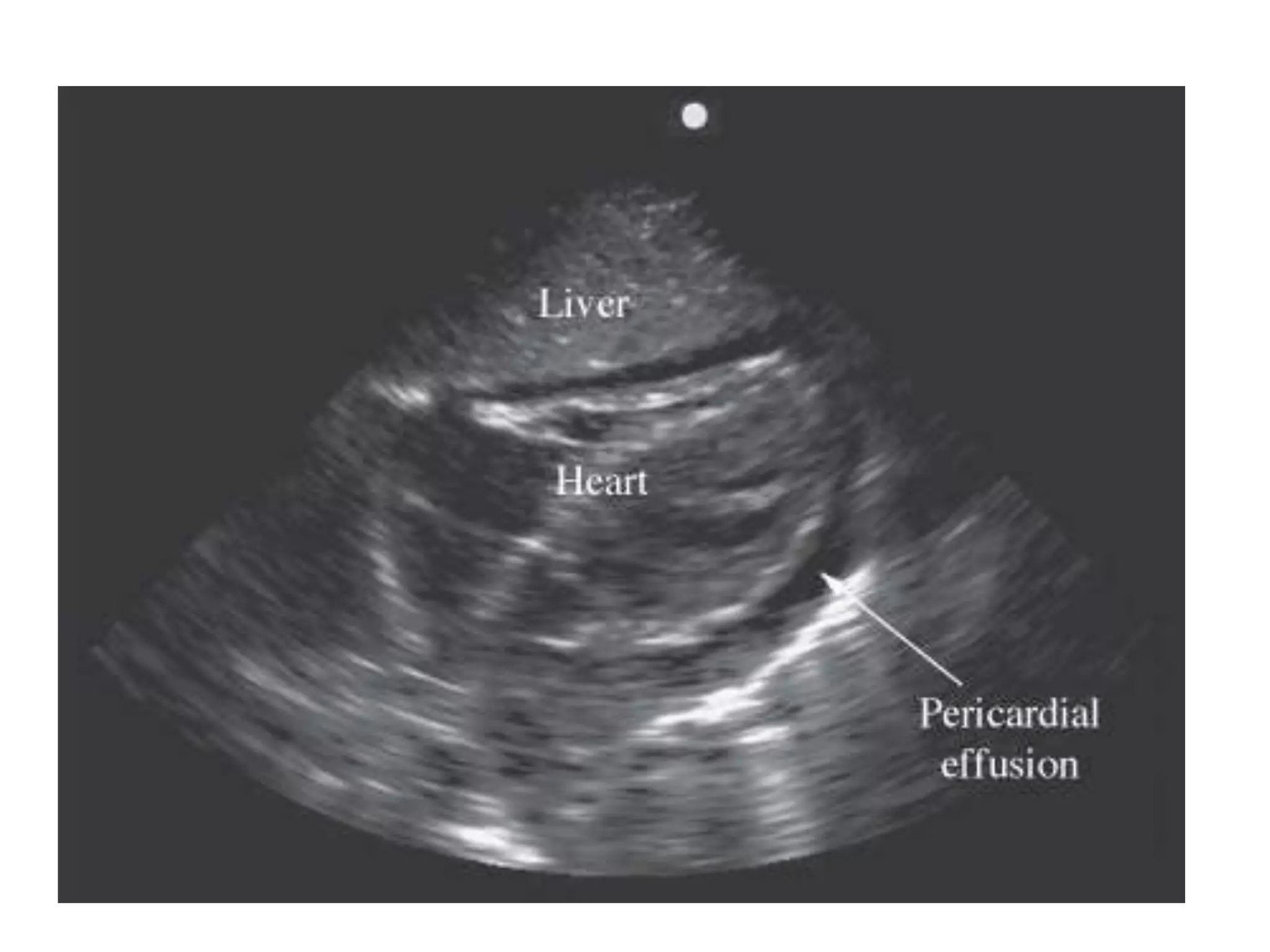 FAST (Focused Assessment Sonography for Trauma) | PPTX