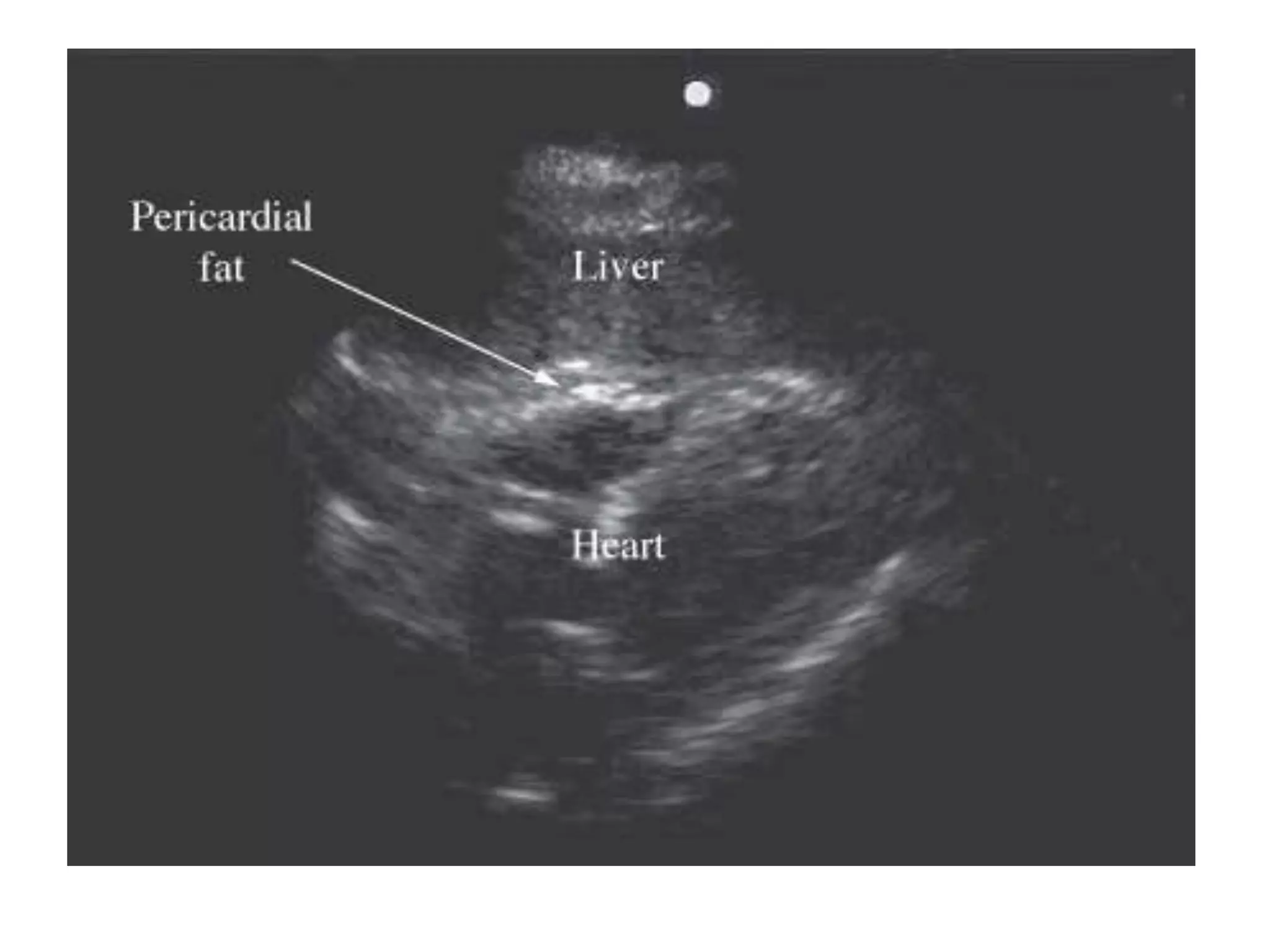 FAST (Focused Assessment Sonography for Trauma) | PPTX