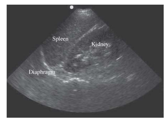 FAST (Focused Assessment Sonography for Trauma) | PPTX