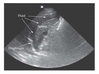 FAST (Focused Assessment Sonography for Trauma) | PPTX
