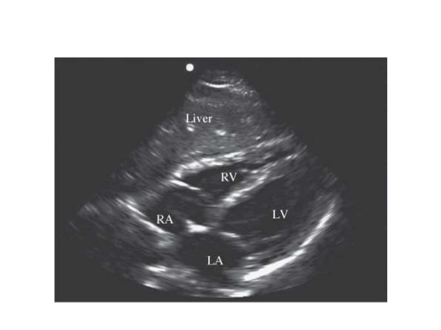 FAST (Focused Assessment Sonography for Trauma) | PPTX