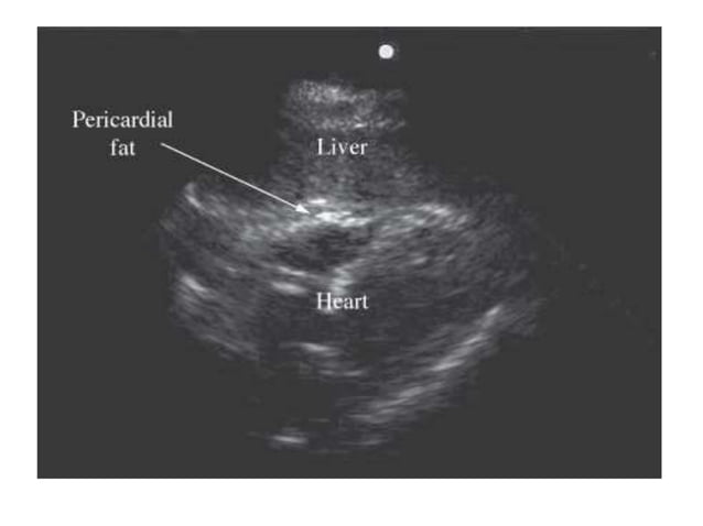 FAST (Focused Assessment Sonography for Trauma) | PPTX