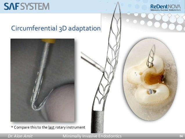 SAF System presentation - July 2014