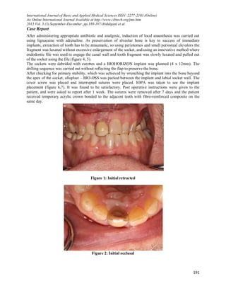 IMMEDIATE IMPLANT PLACEMENT WITH ONE YEAR FOLLOW-UP: A CASE REPORT | PDF | Dental Health ...