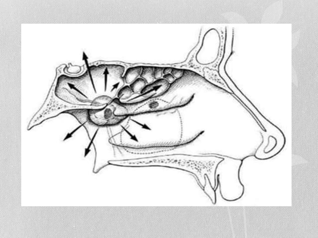 JNA | PPTX | Ear, Nose and Throat Conditions | Diseases and Conditions