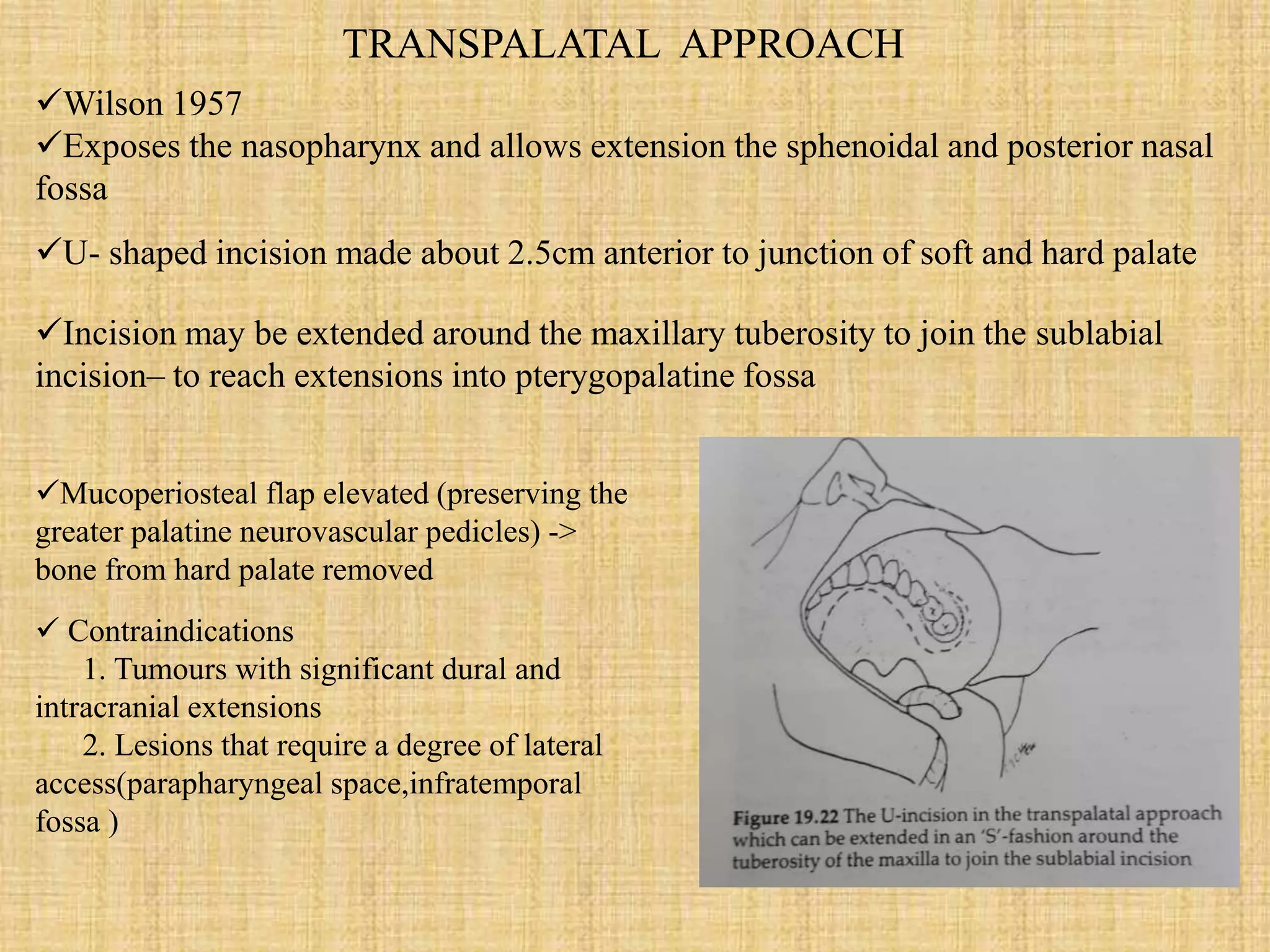 Jna(juvenile nasopharyngeal angiofibroma) current treatment modalities | PPTX
