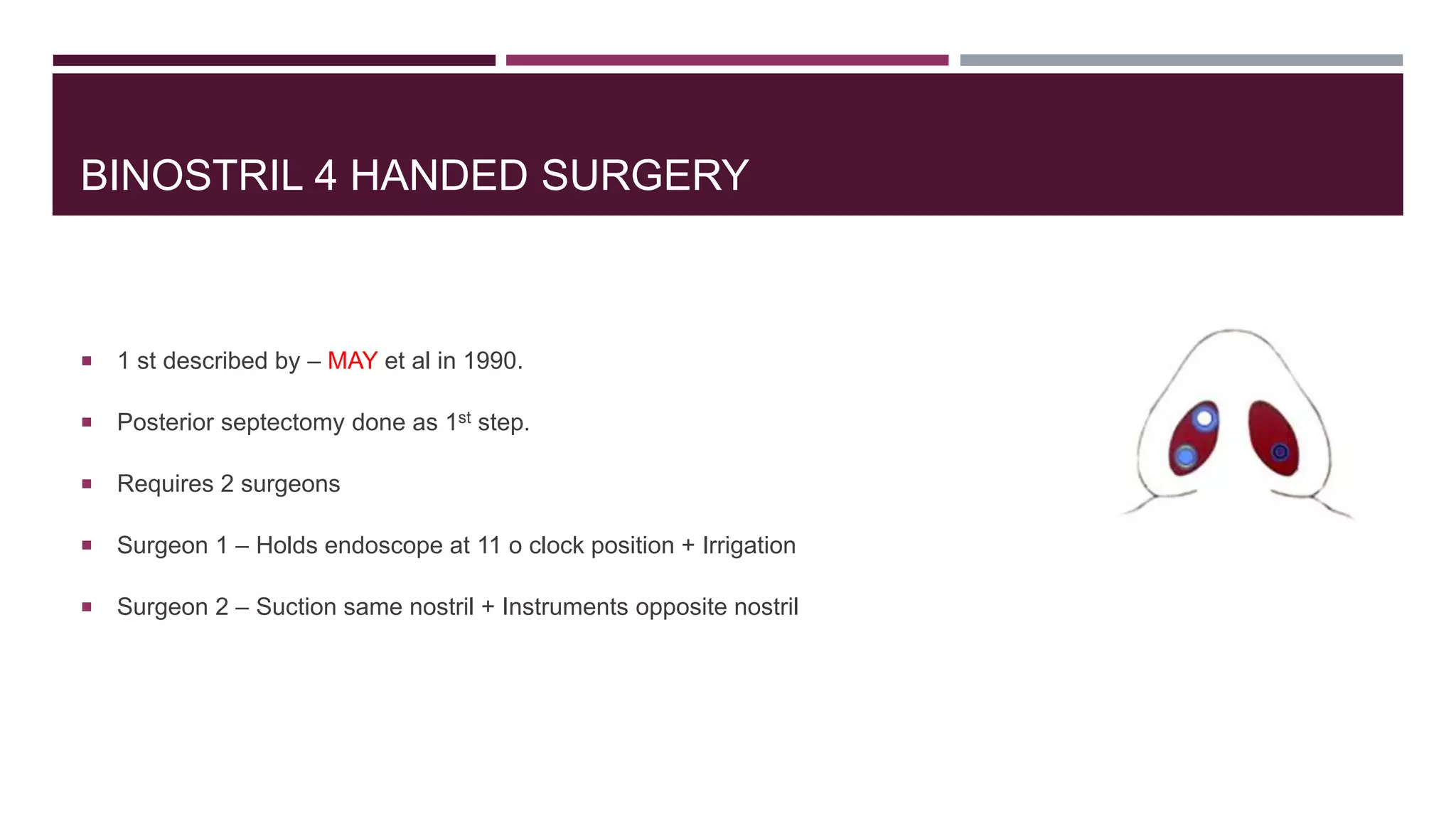 JUVENILE NASOPHARYNGEAL ANGIOFIBROMA Surgical approaches & newer ...