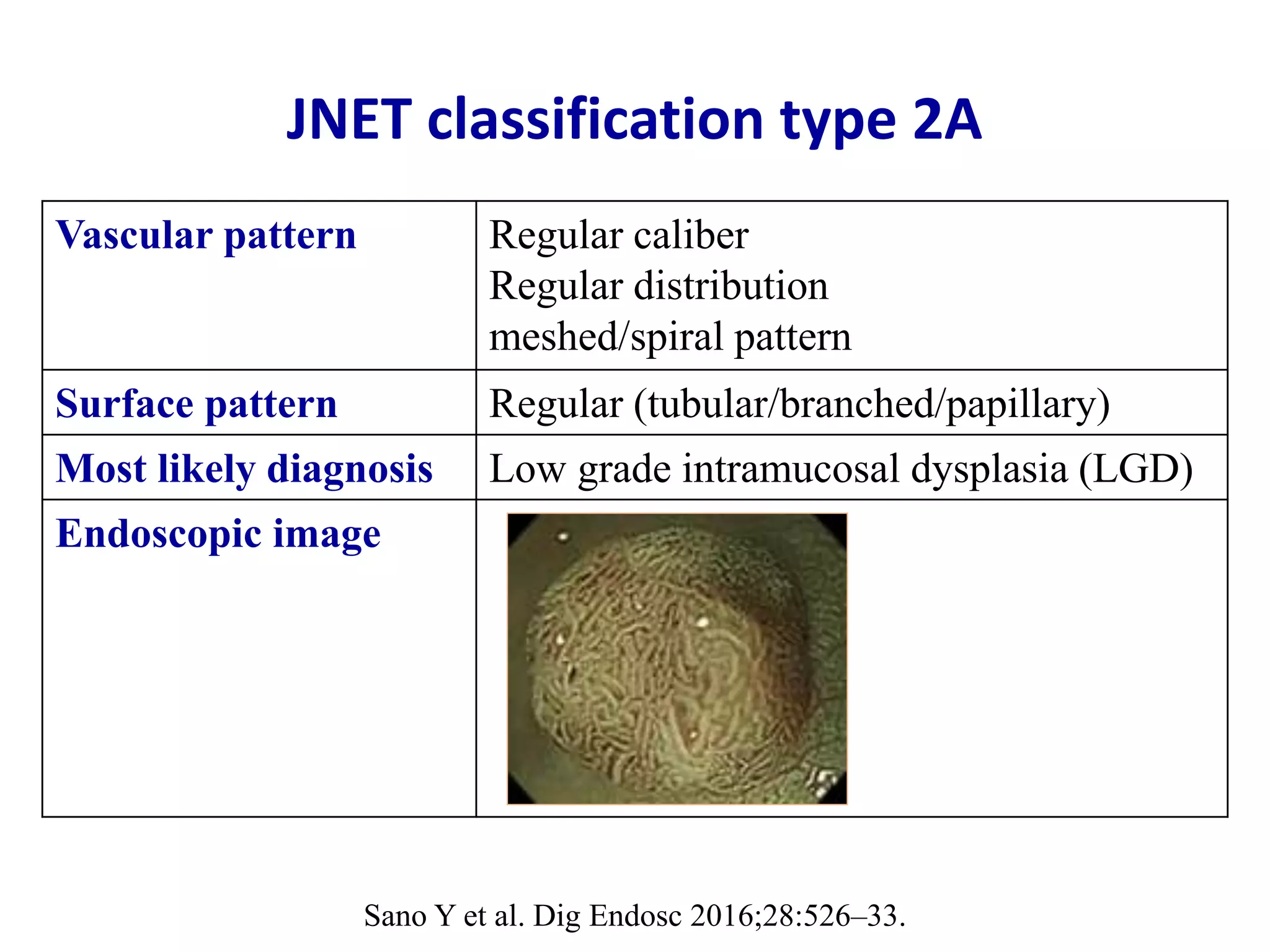 JNET classification of colo rectal polyps | PPTX