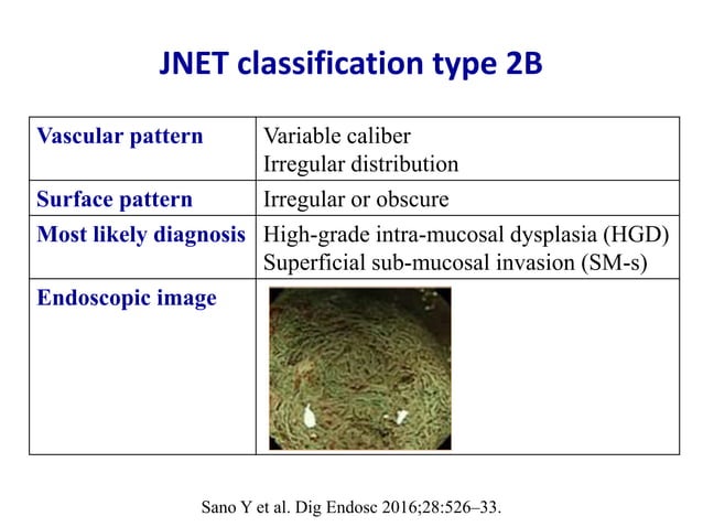 JNET classification of colo rectal polyps | PPTX | Medical Health