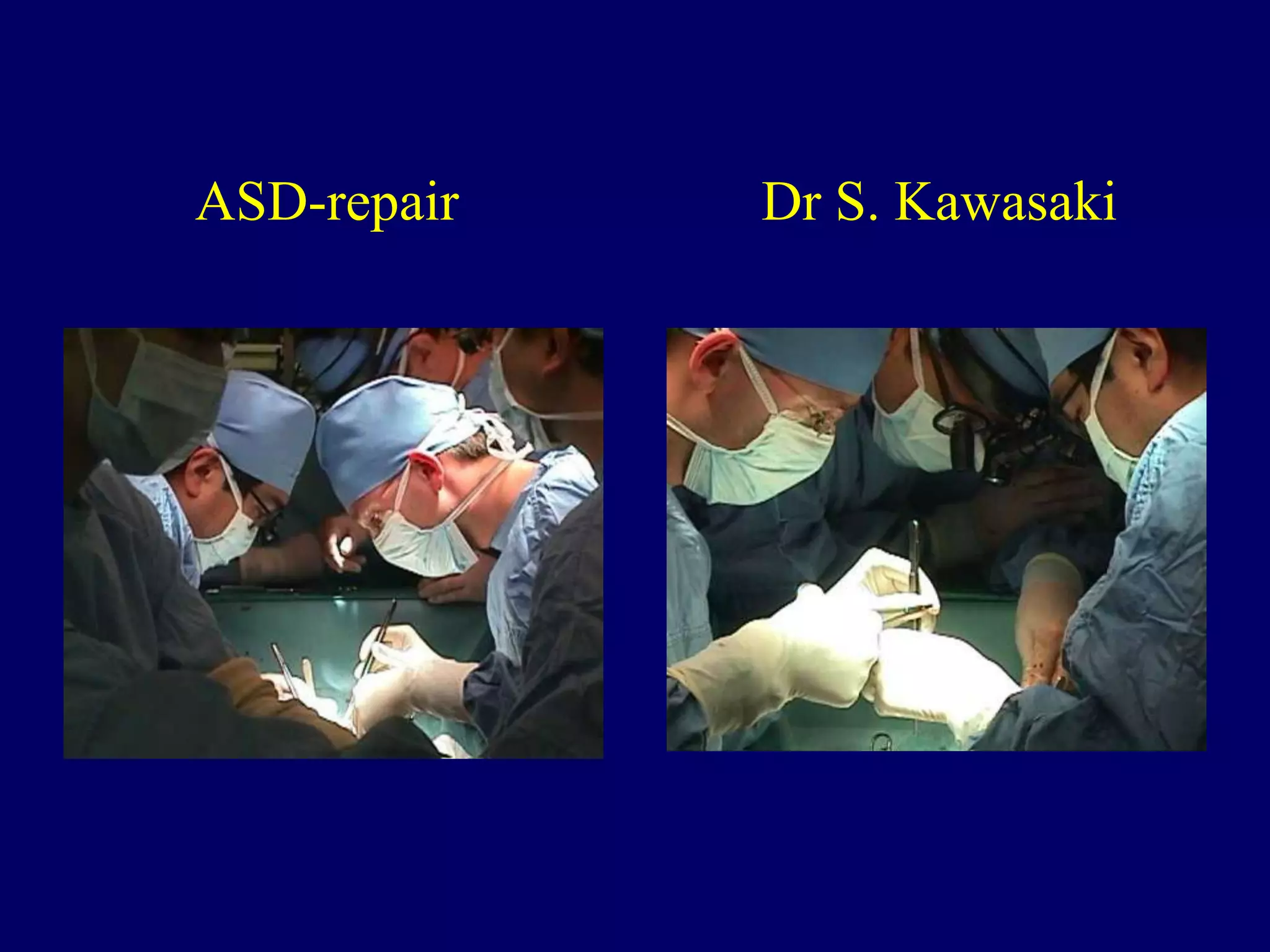 Jni presentation | PPT