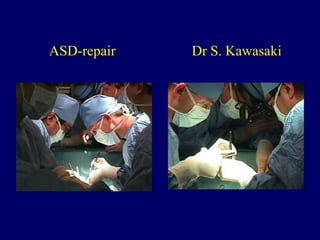 Jni presentation | PPT