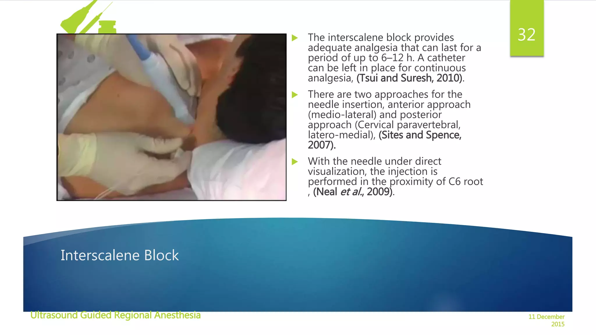 Ultrasound Guided Regional Anesthesia | PPSX