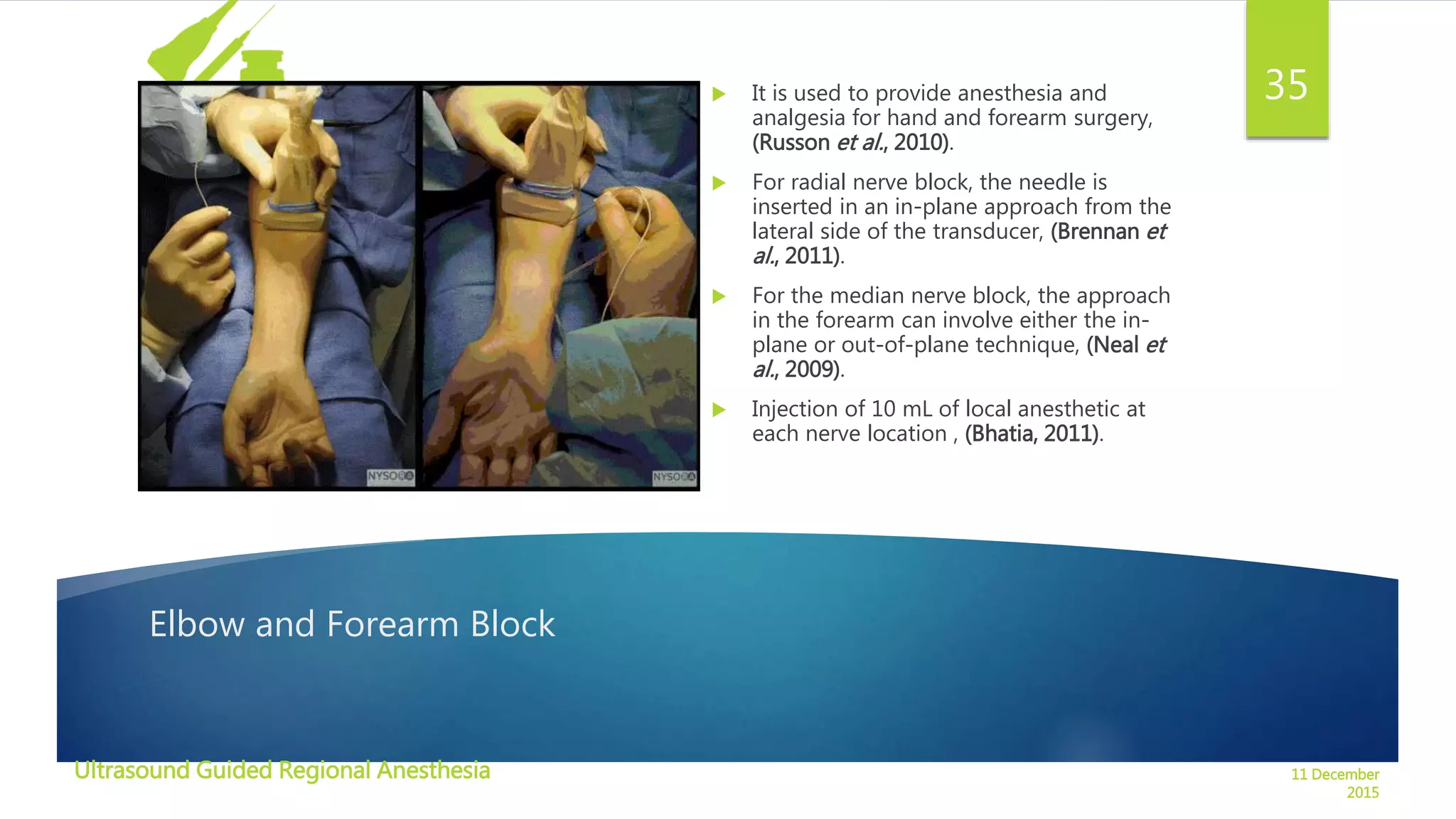 Ultrasound Guided Regional Anesthesia | PPSX