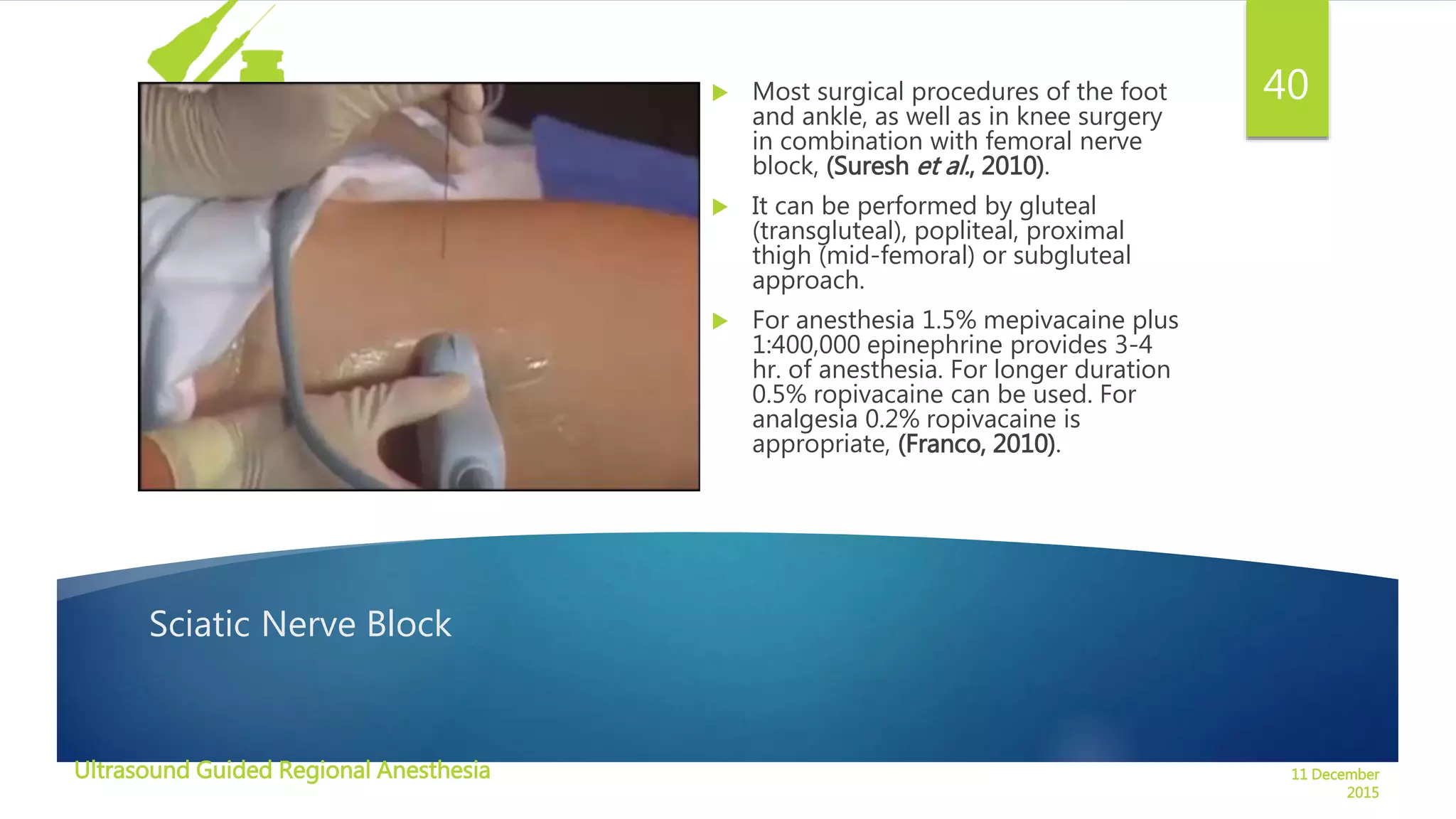 Ultrasound Guided Regional Anesthesia | PPSX