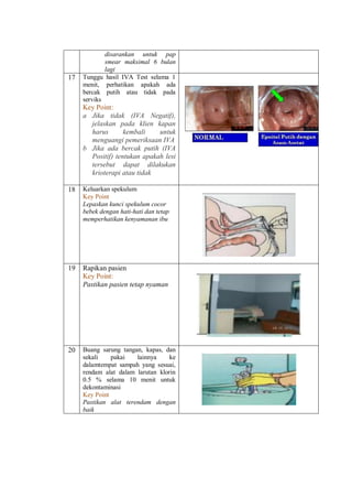 Job sheet PAP Smear dan IVA Test | PDF