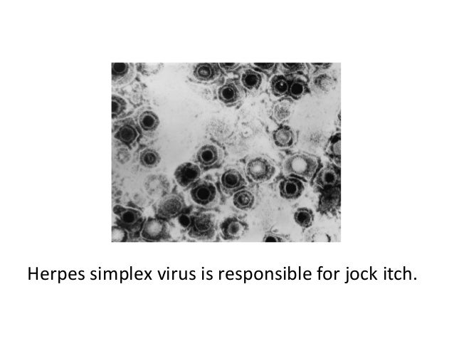 Herpes Or Jock Itch Find Out The Answer Here