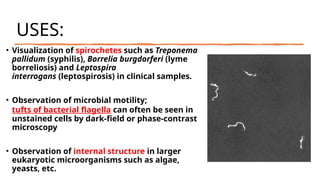 Dark-field microscopy (also called dark-ground microscopy) describes ...