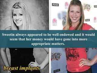 Jodie Sweetin Plastic Surgery Before And After Celebrity