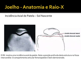 Radiografia Da Fossa Intercondilar