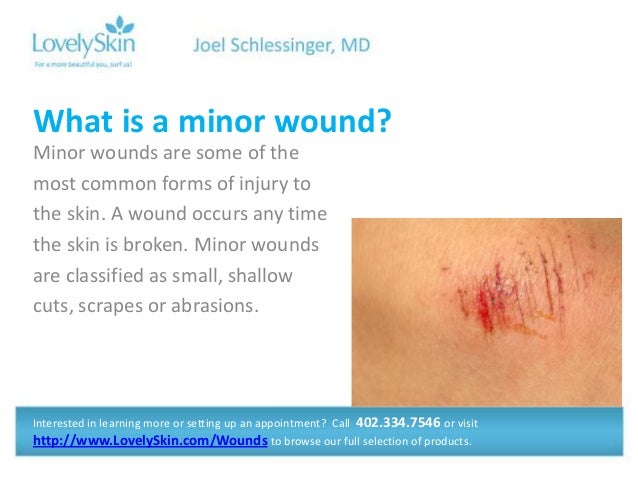 Joel Schlessinger MD - FAQ Healing Minor Wounds