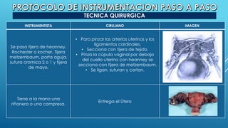 Histerectomia Paso por Paso | PPTX