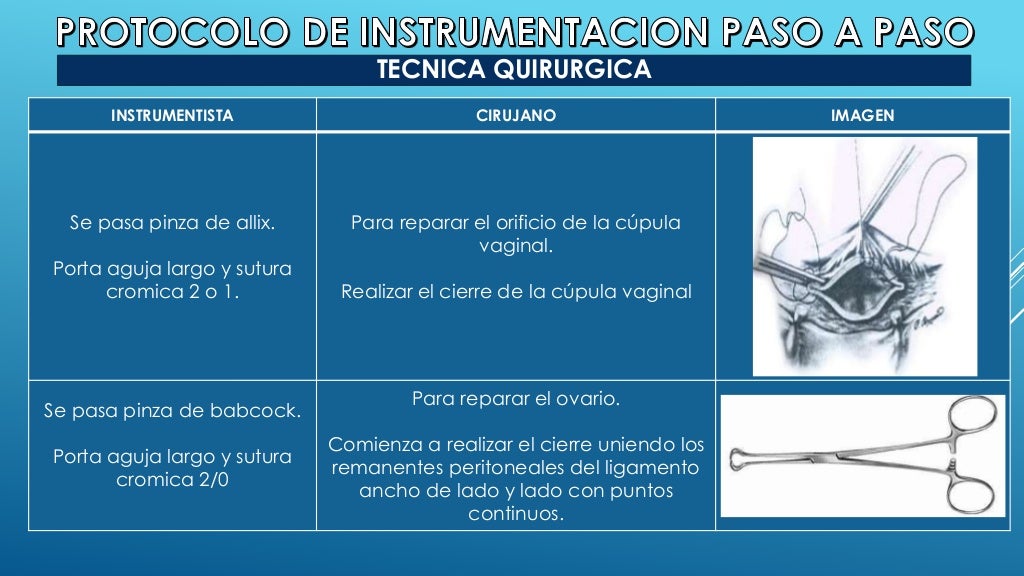Histerectomia Paso por Paso