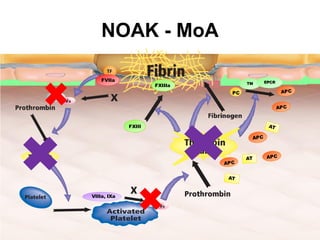 NOAC, DOAC, TEG, ROTEM, ICH, SAH. | PPT