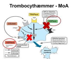 NOAC, DOAC, TEG, ROTEM, ICH, SAH. | PPT | Free Download