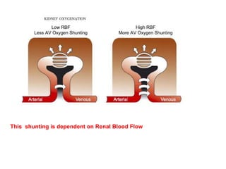 ICN Victoria: Botha on Acute Renal Failure | PPT