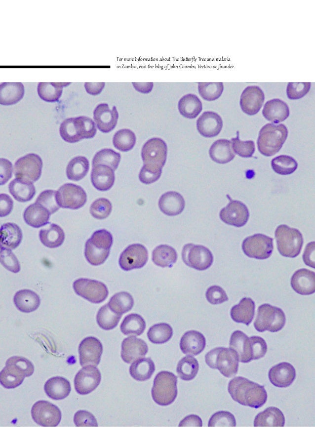 The Butterfly Tree and Malaria | PDF