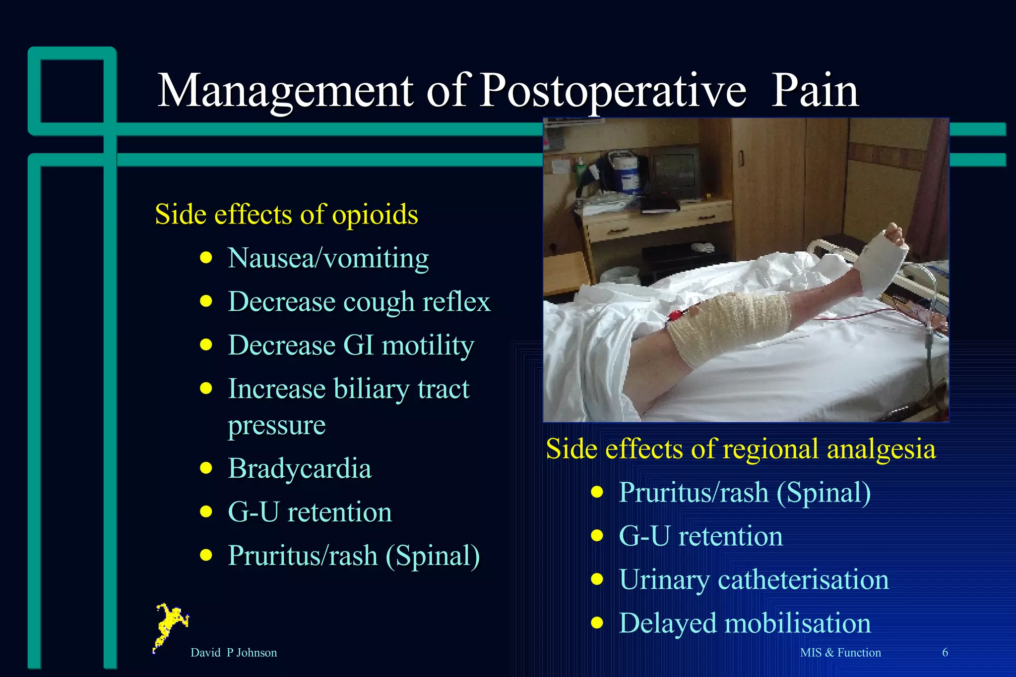 Johnson Dp. Mis Knee Replacement. What Are The Functional Benefits ...