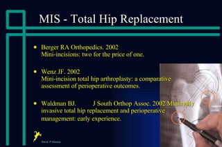 Johnson Dp. Mis Knee Replacement. What Are The Functional Benefits ...