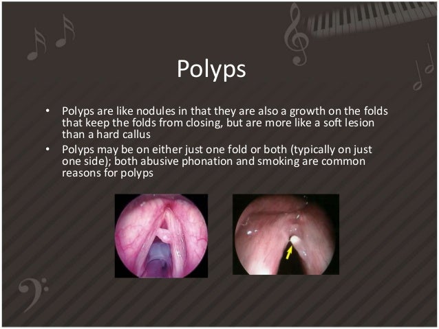 Protecting your Hearing