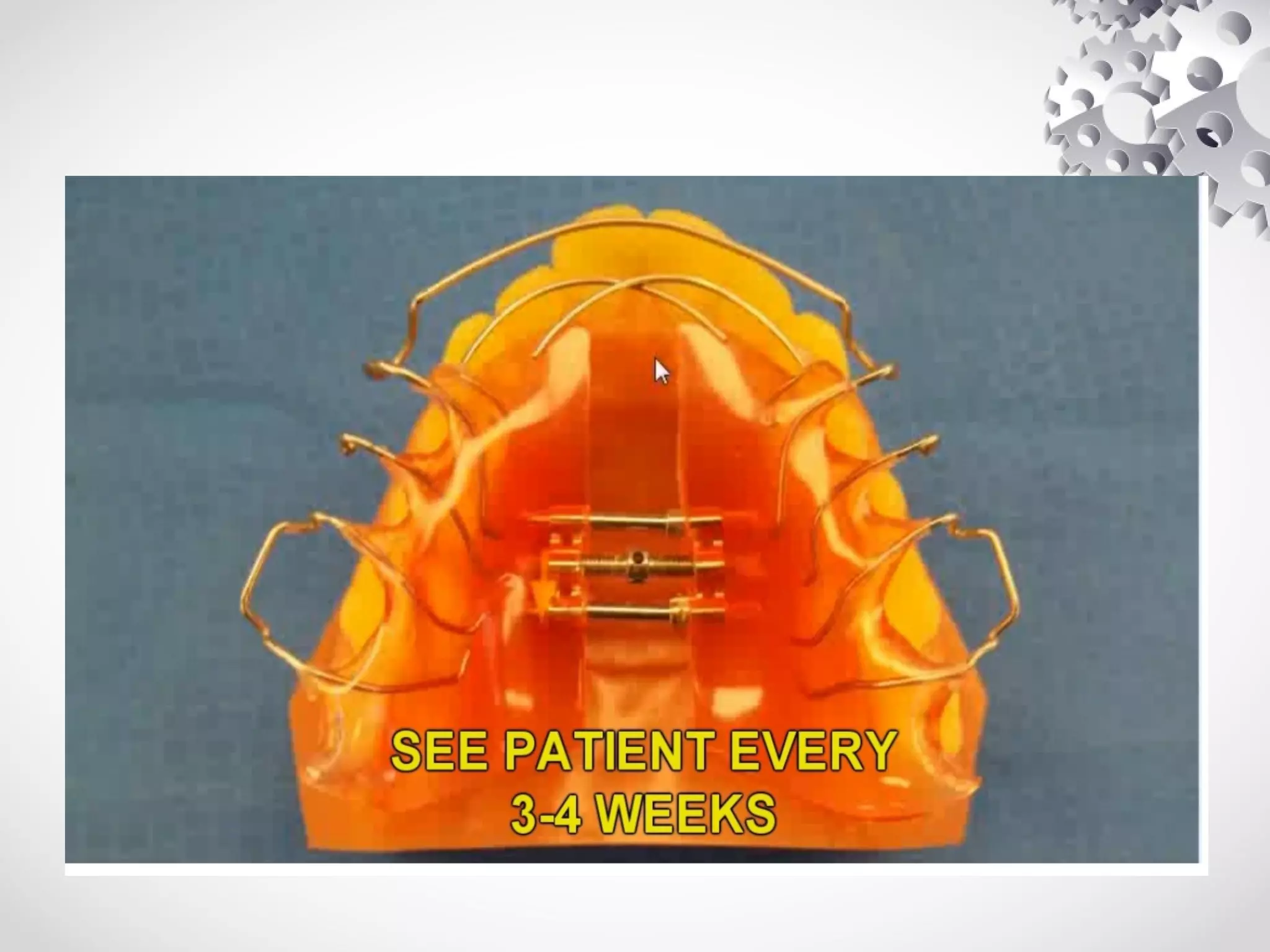 EXPANSION SCREWS | PPT