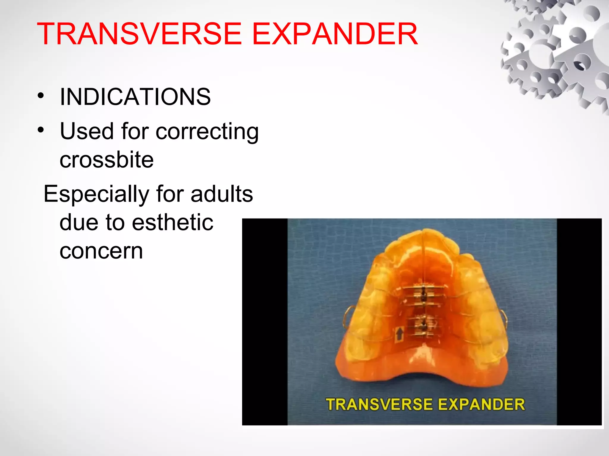 EXPANSION SCREWS | PPT