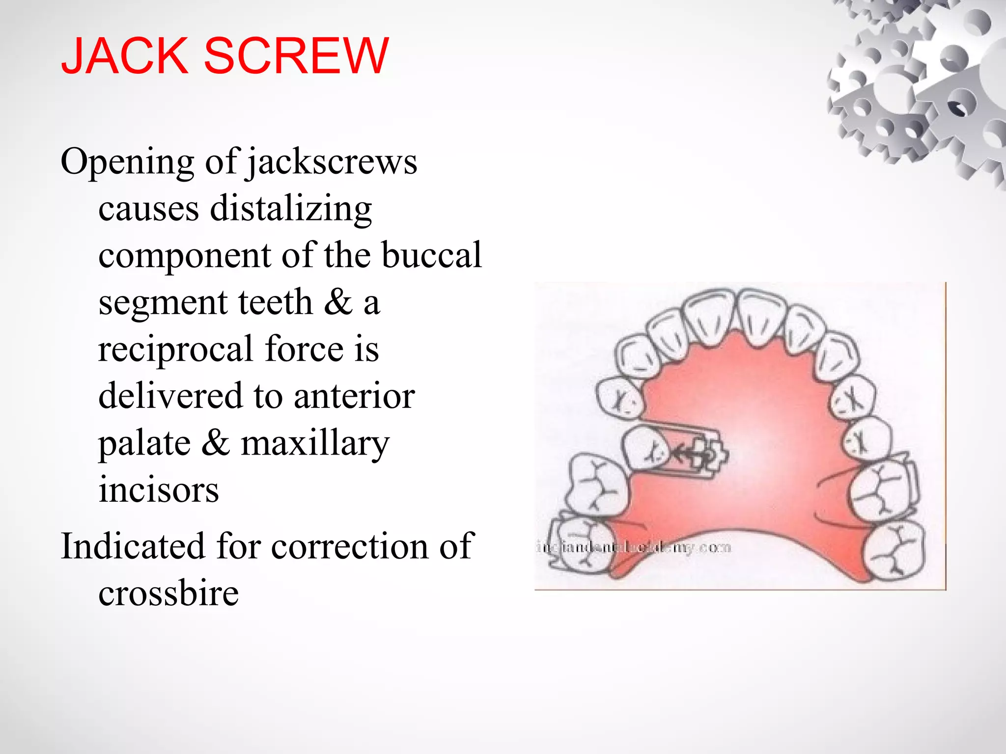 EXPANSION SCREWS | PPT
