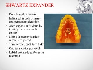 EXPANSION SCREWS | PPT