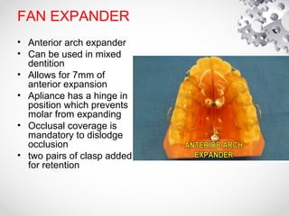 EXPANSION SCREWS | PPT