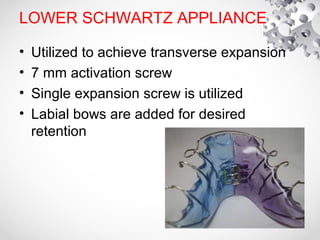 EXPANSION SCREWS | PPT