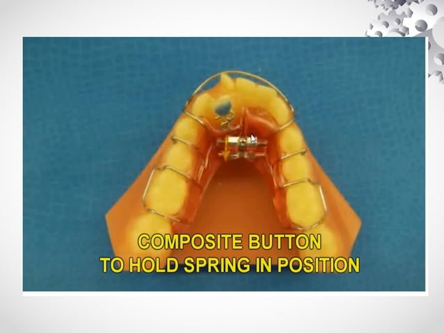 EXPANSION SCREWS | PPT