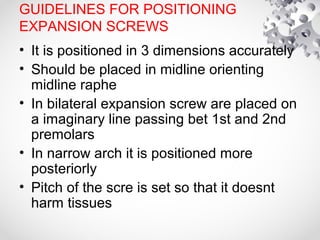 EXPANSION SCREWS | PPT