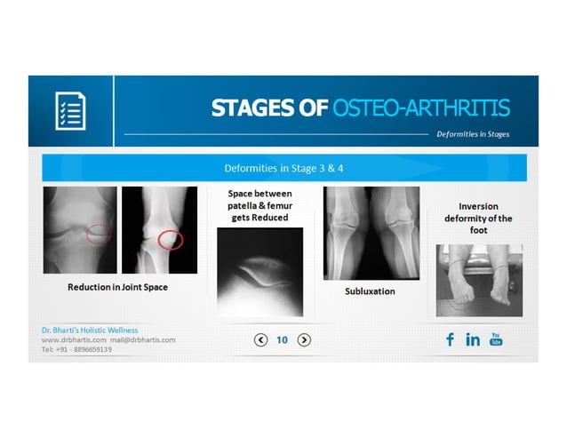 Osteo-Arthritis Information Booklet | PDF