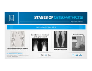 Osteo-Arthritis Information Booklet | PDF