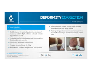 Osteo-Arthritis Information Booklet | PDF